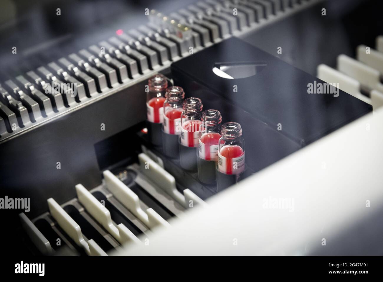 Blood type detection procedute using laboratory equpment at clinical ...