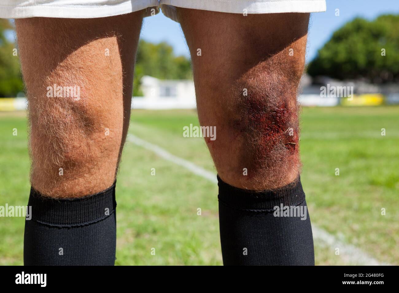 Mid section of rugby player with injured knee standing at playing field ...