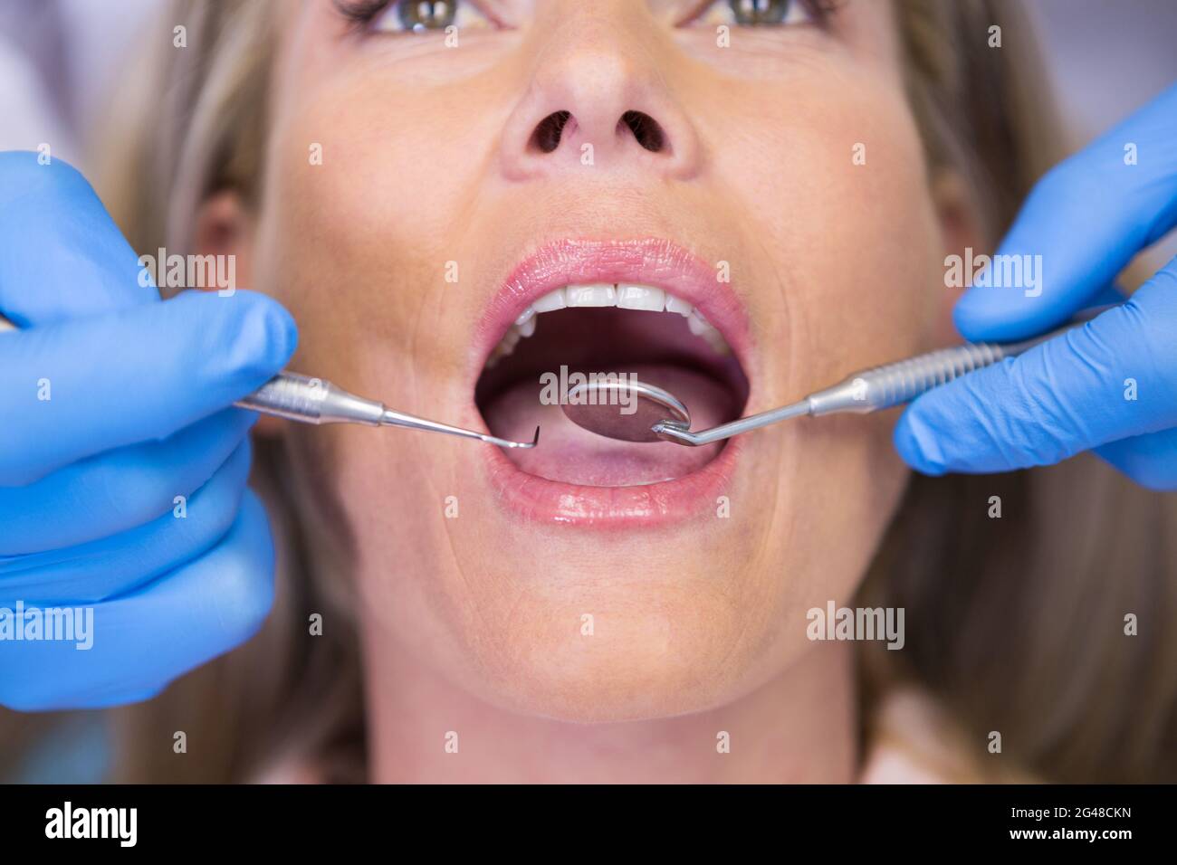 Close up dental assistant examining hi-res stock photography and images ...