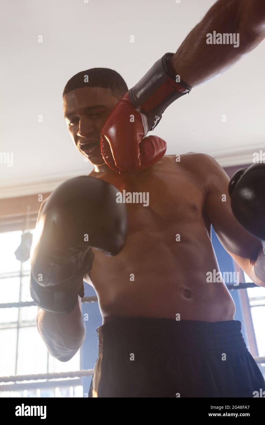 Boxing mouthguard hi-res stock photography and images - Alamy