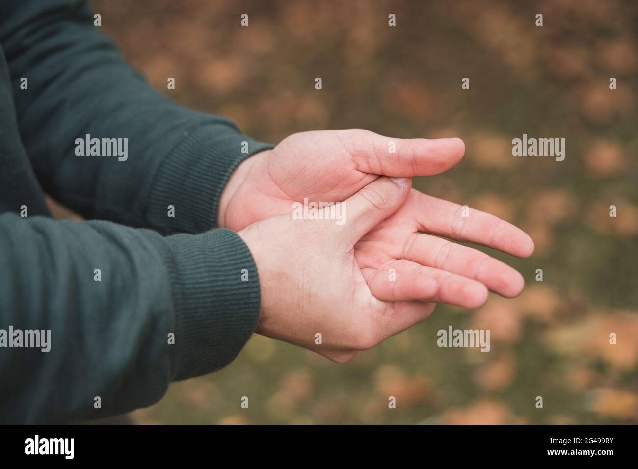 Man scratching itchy palm hi-res stock photography and images - Alamy