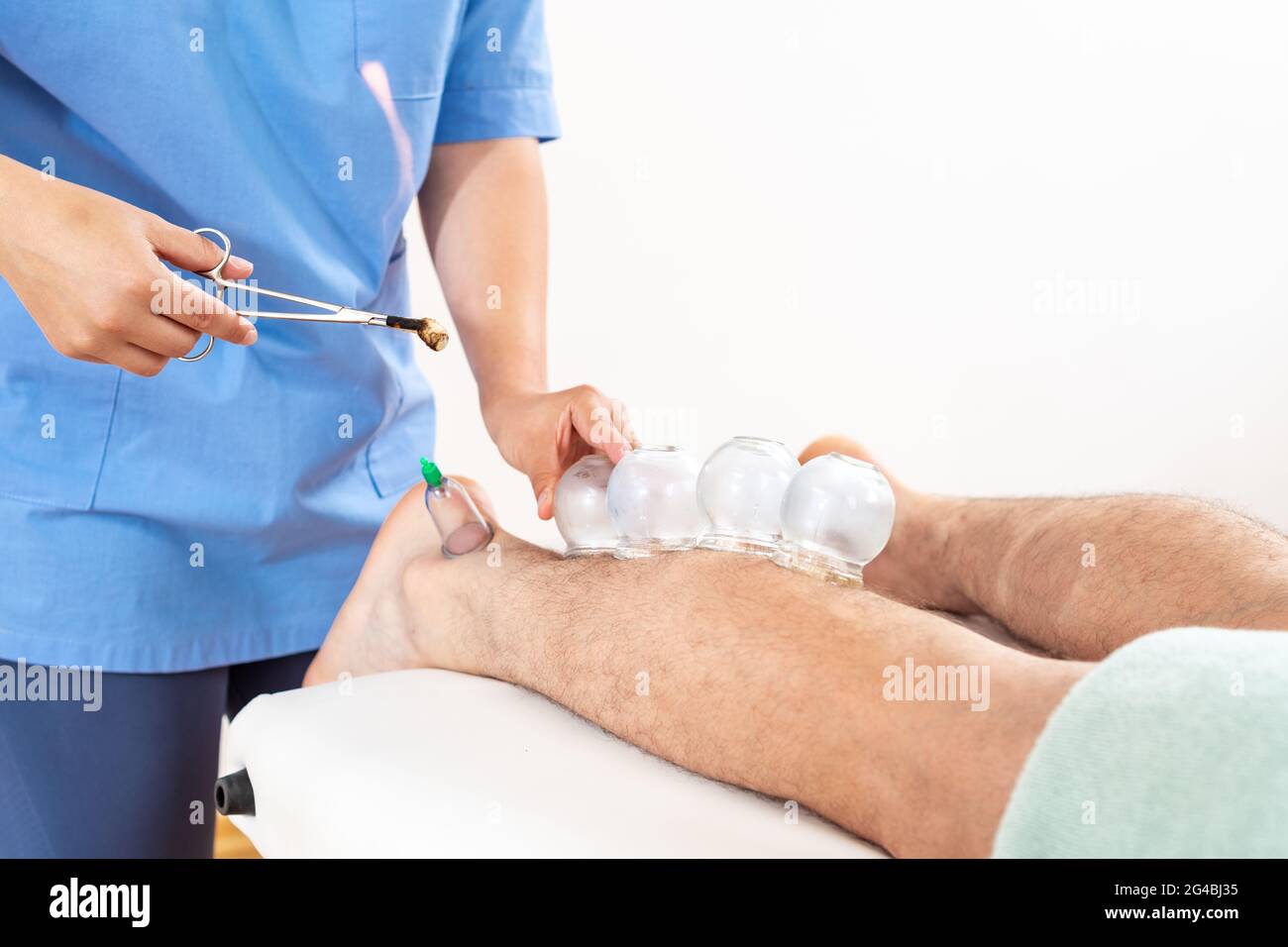 Cupping therapy leg hi-res stock photography and images - Alamy