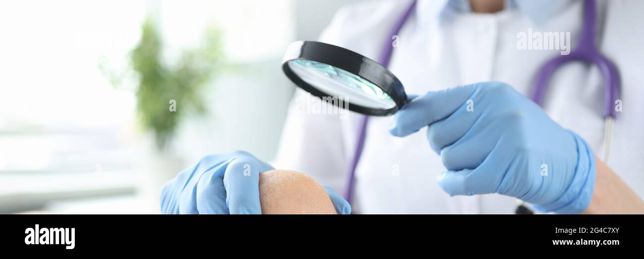 Doctor examining cracks in patients heels using magnifying glass ...