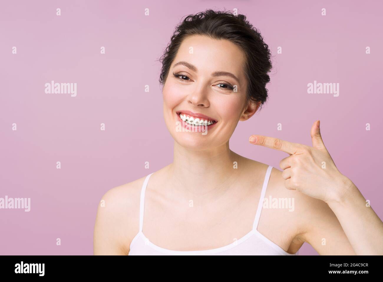 Orthodontic Treatment. Dental Care Concept. Beautiful Woman Healthy ...