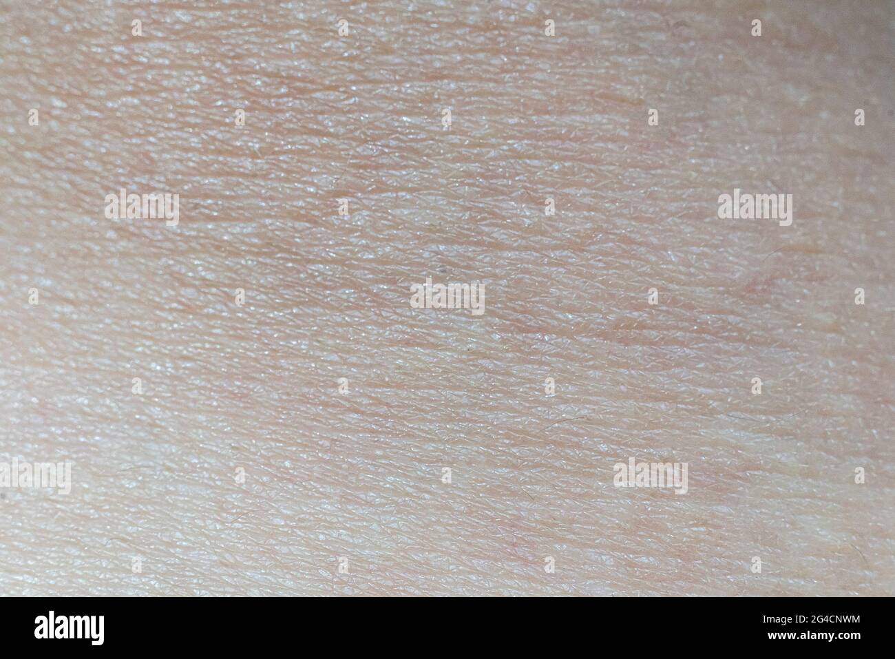 close up macro texture of the human caucasian skin Stock Photo - Alamy