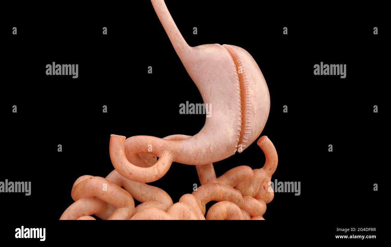 Stomach reduction surgery technique as 3D rendering Stock Photo - Alamy