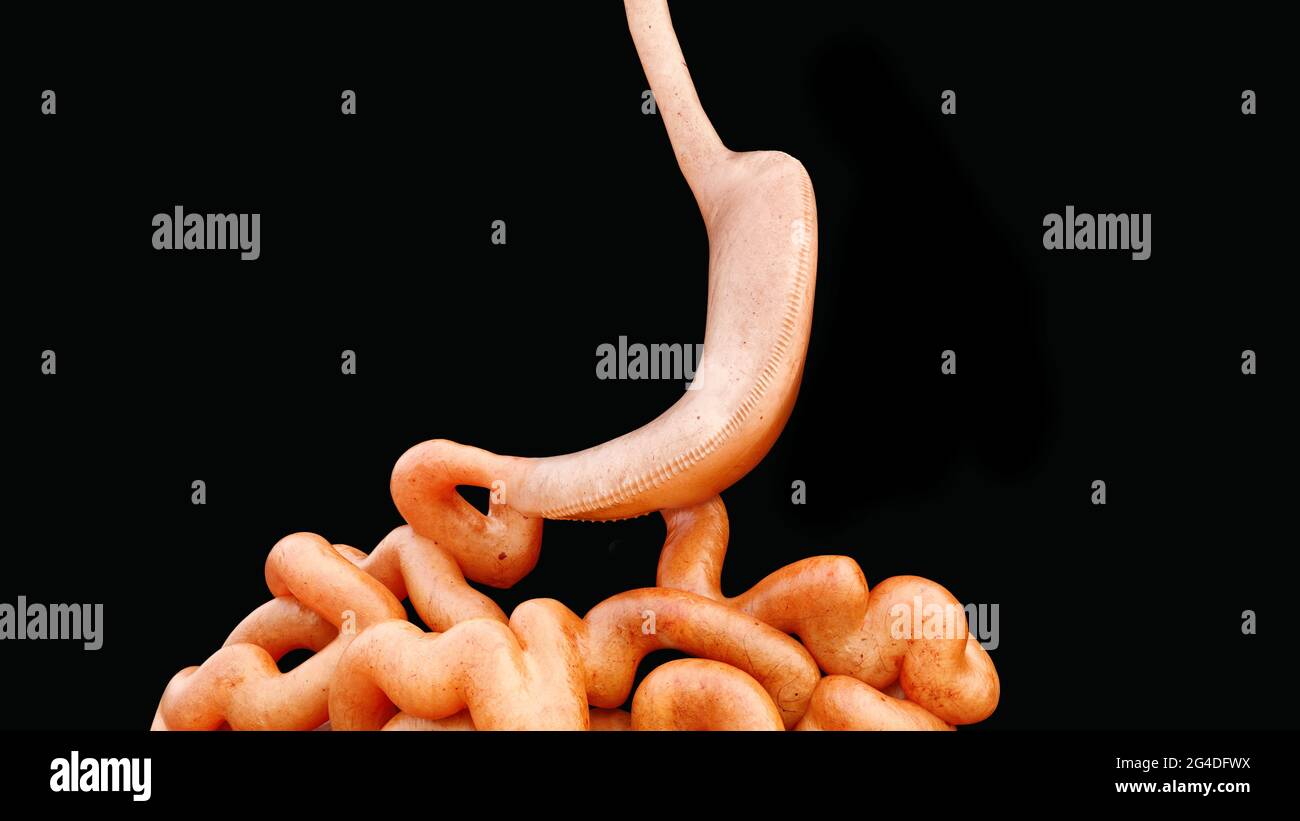 Stomach reduction surgery technique as 3D rendering Stock Photo - Alamy