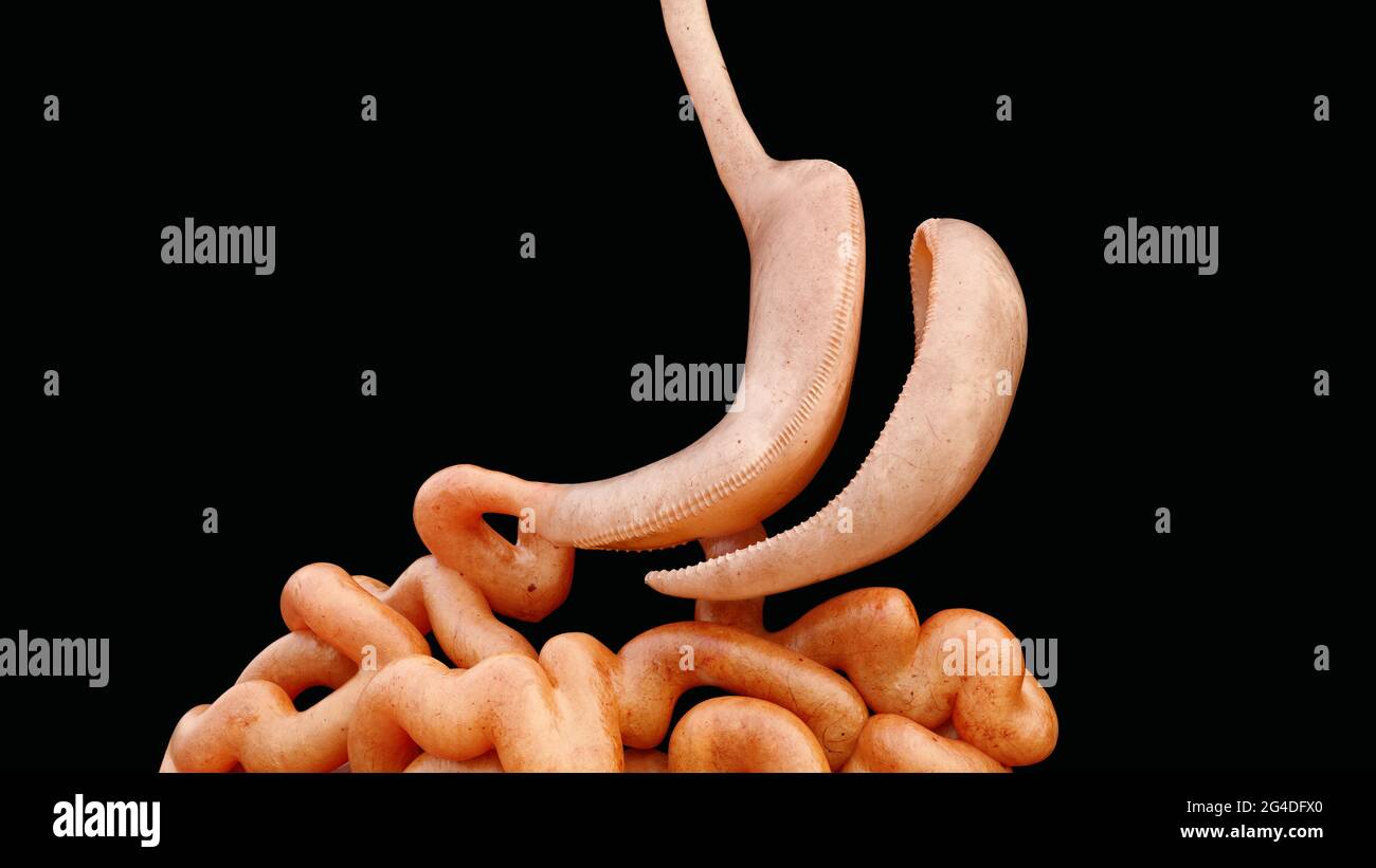 Stomach reduction surgery technique as 3D rendering Stock Photo - Alamy