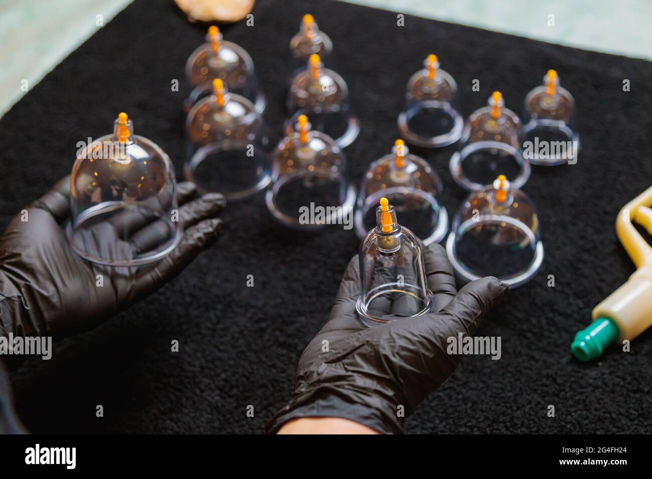 Vacuum vessels for the curative procedure of hijama bloodletting ...