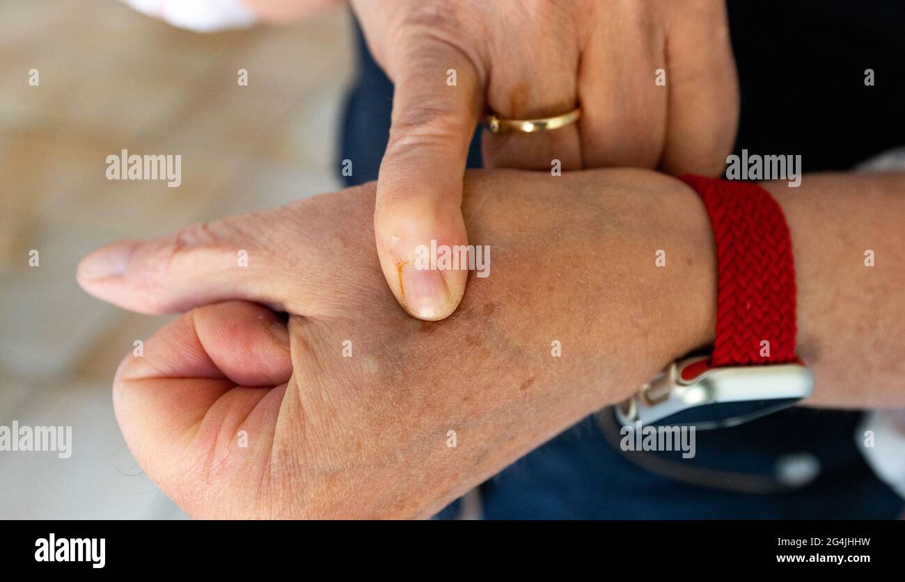 Under skin implants hi-res stock photography and images - Alamy