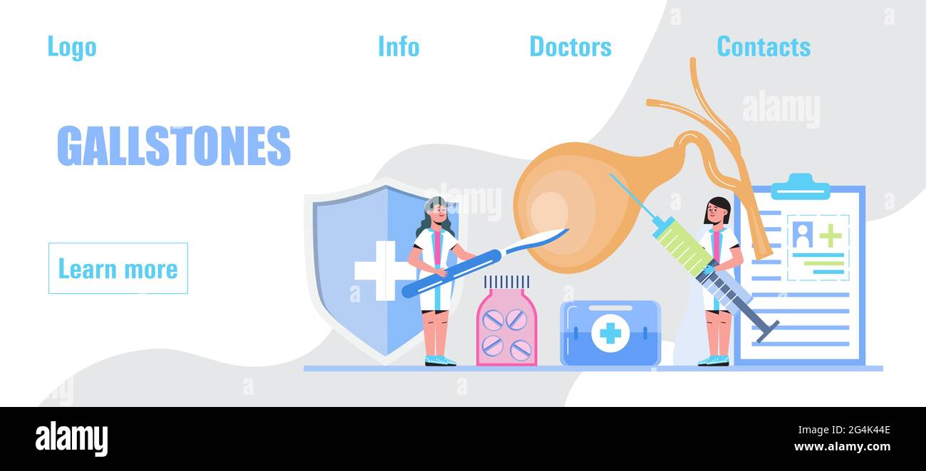 Gallbladder concept vector. Doctors treat gallstones. Biliary ...