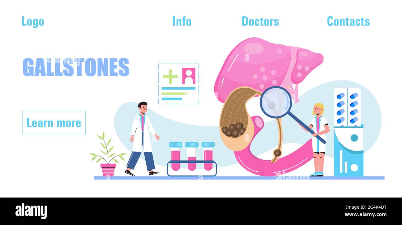 Gallbladder concept vector. Doctors treat gallstones. Biliary ...