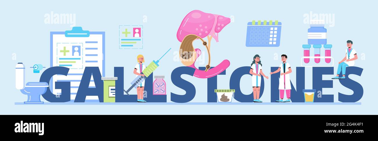 Gallbladder concept vector. Doctors treat gallstones. Biliary ...