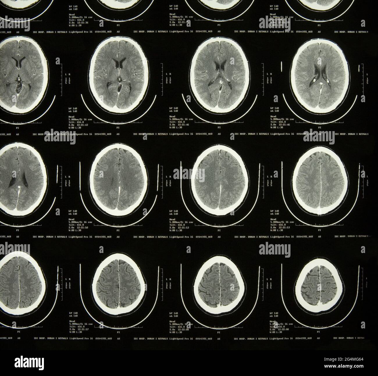 MRI Brain scan Stock Photo - Alamy