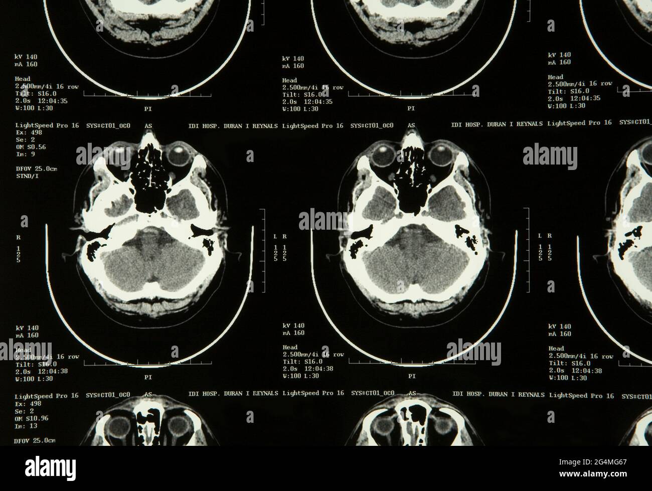 Nmr body scanner hi-res stock photography and images - Alamy
