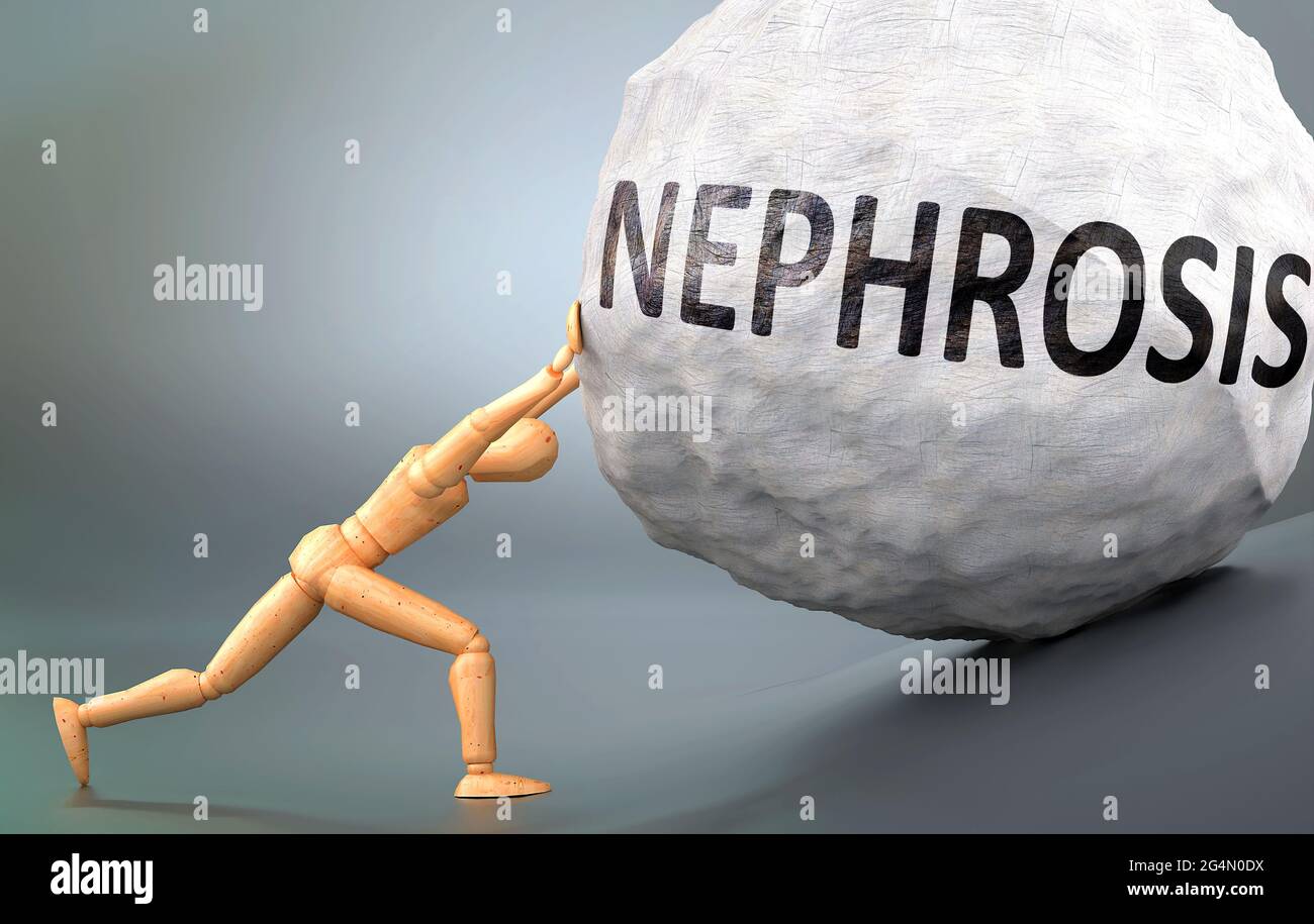 Nephrosis and painful human condition hi-res stock photography and ...