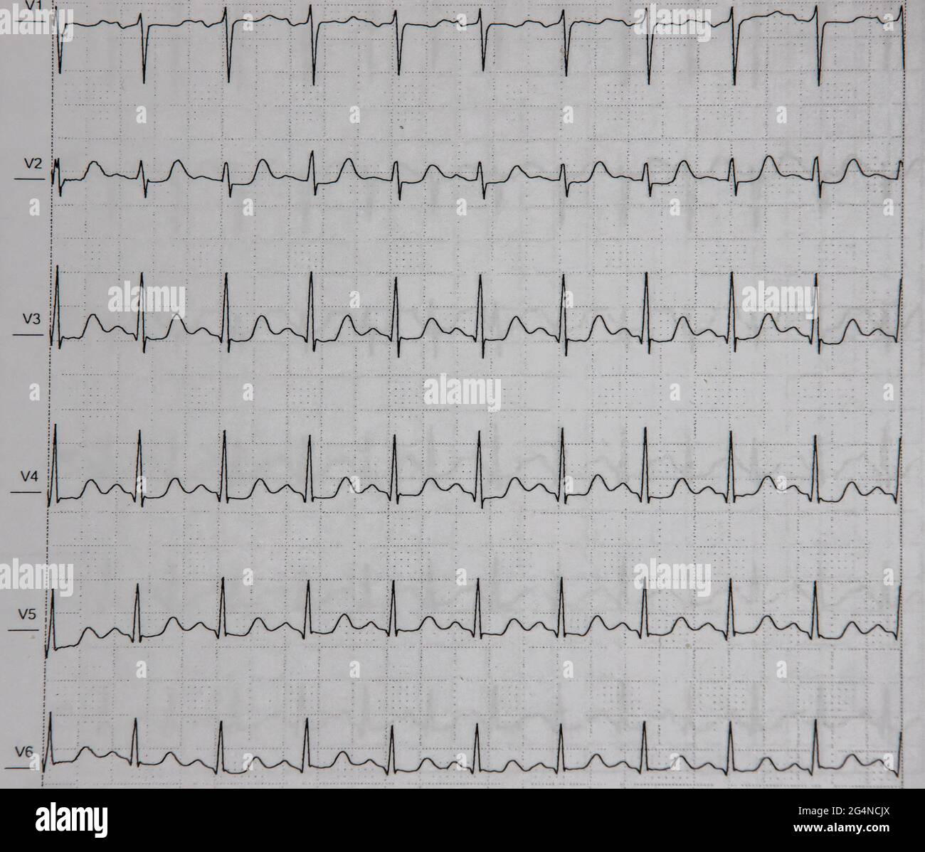 Closeup of cardiogram EKG with the heartbeat Stock Photo - Alamy