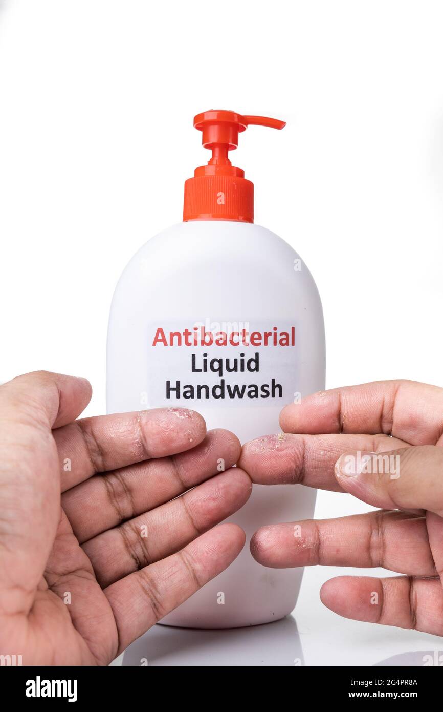 Dry skin on finger with bottle of antibacterial liquid handwash ...