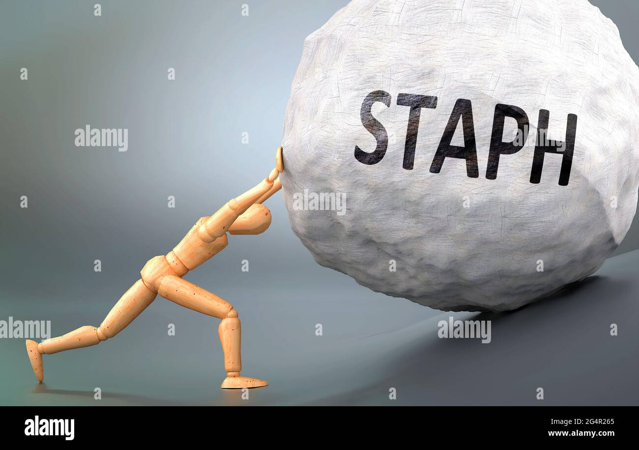 Staph and painful human condition hi-res stock photography and images ...