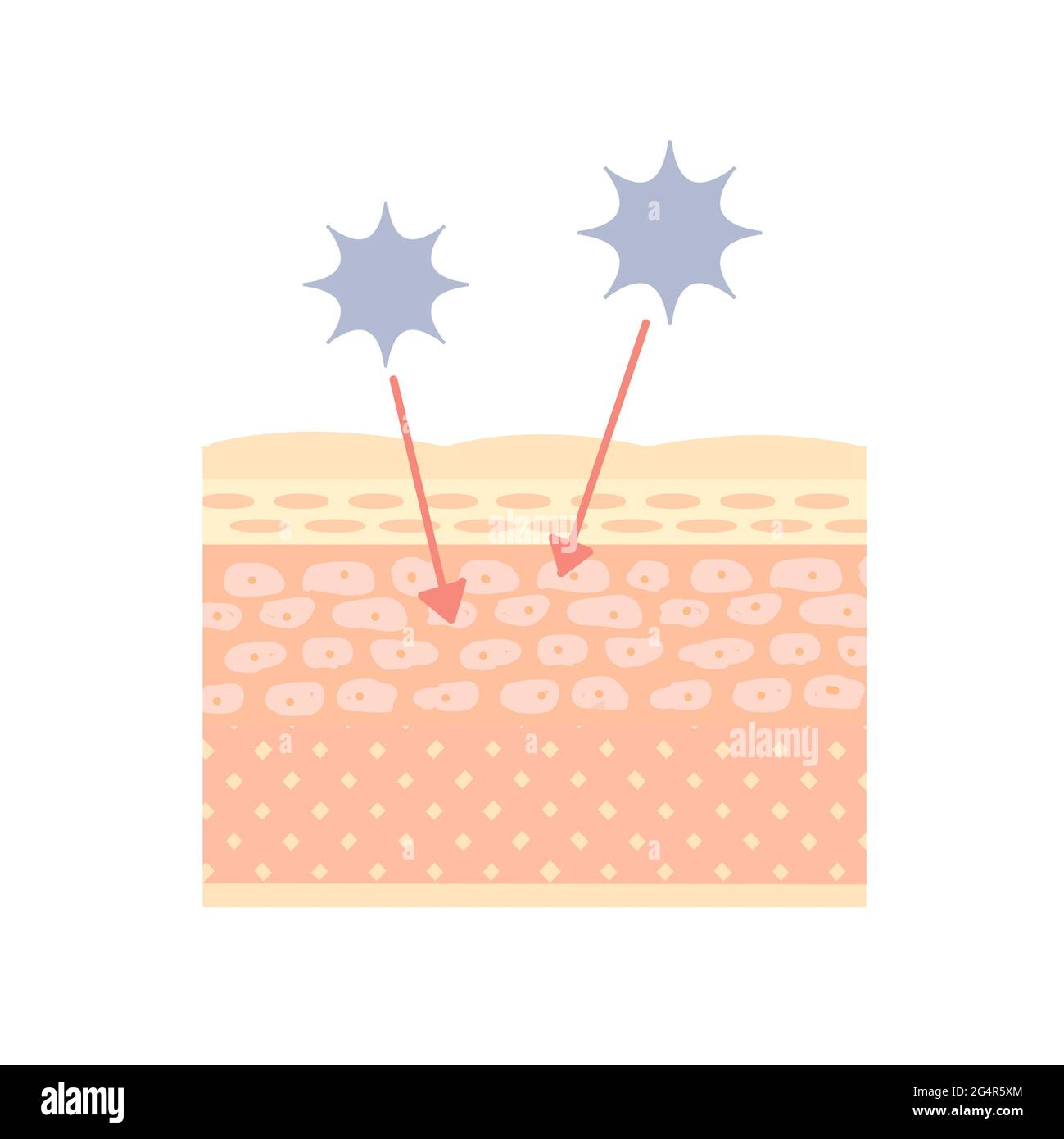 Image of skin with reduced barrier function. On a white background ...