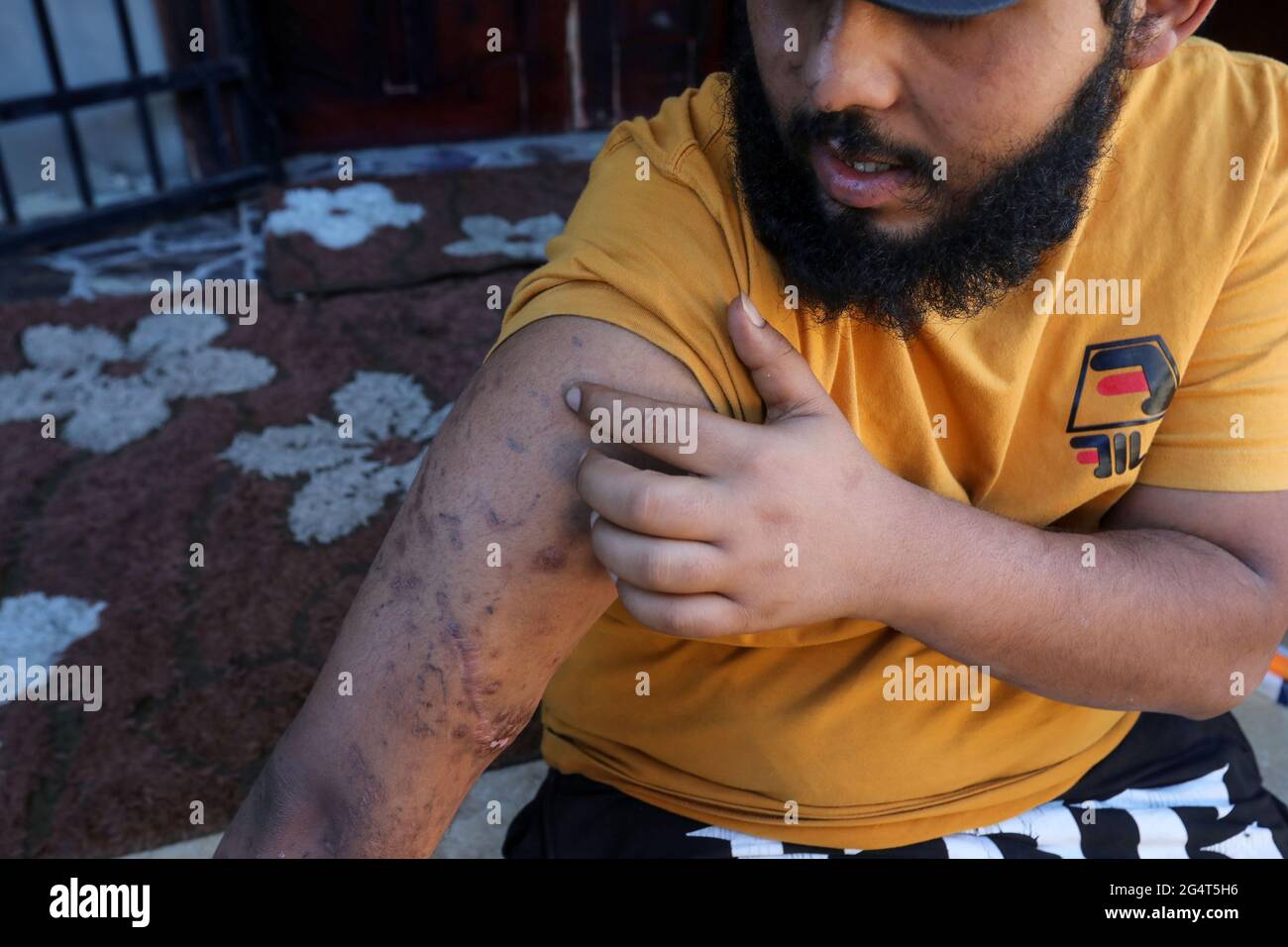 Landmine picture hi-res stock photography and images - Alamy