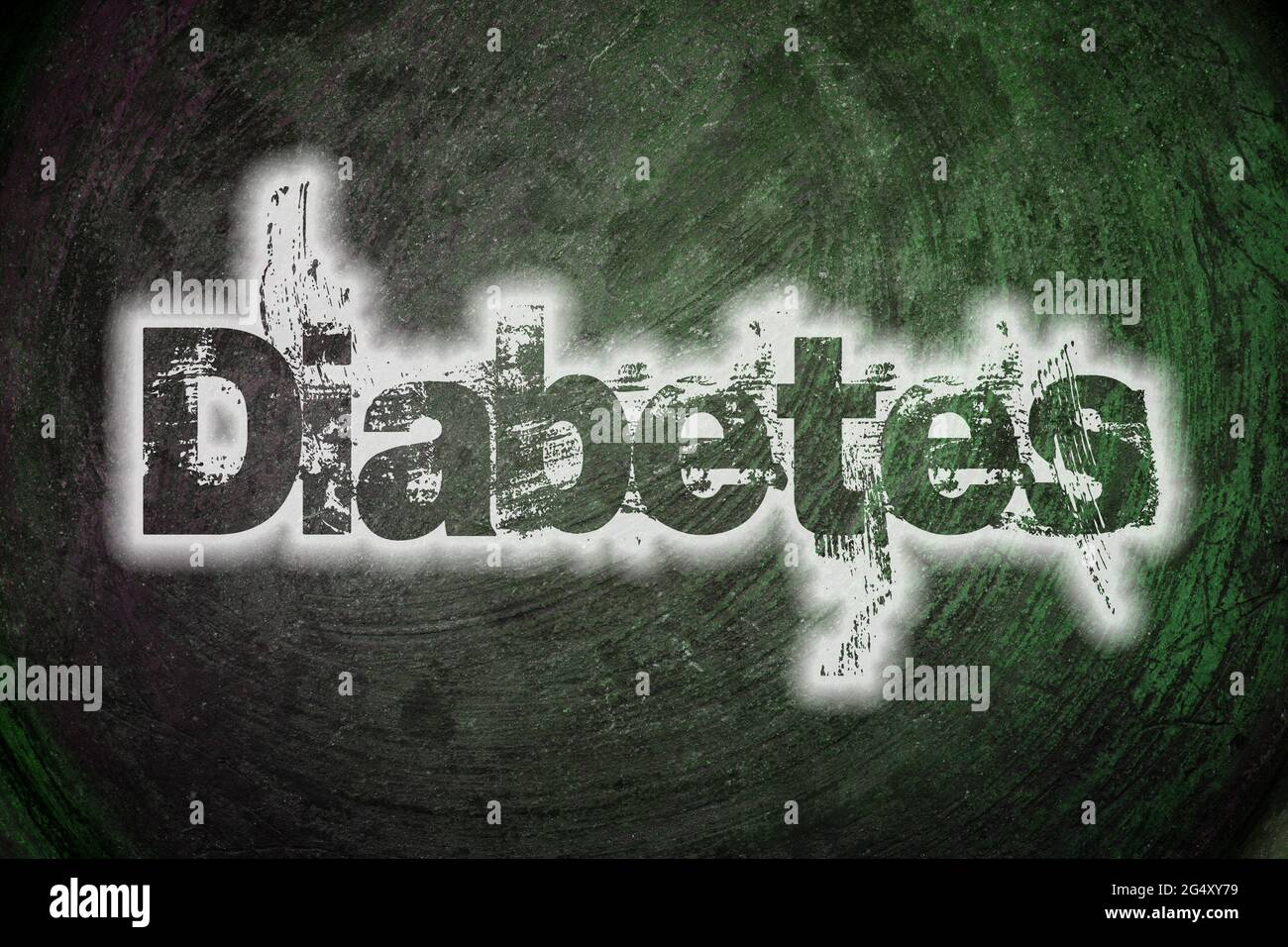 Symptoms diabetes hi-res stock photography and images - Alamy