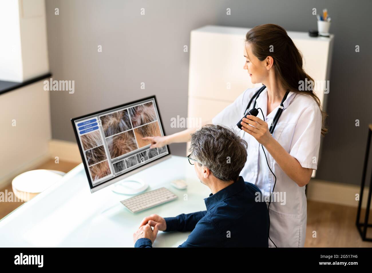 Hair Scalp Analysis In Clinic. Man With Hair Fall And Dandruff Stock ...