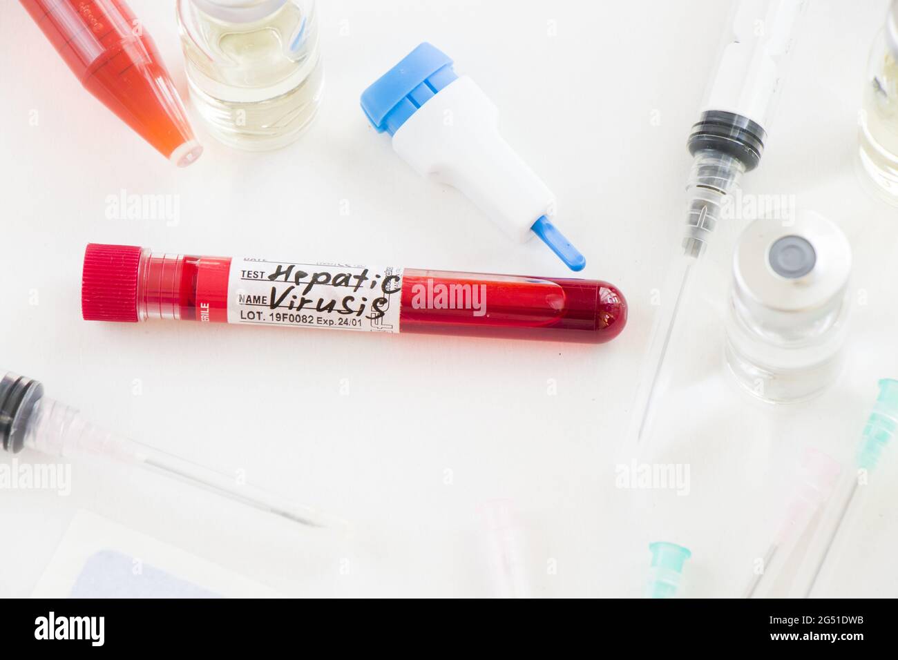 Hepatitis a lab hi-res stock photography and images - Alamy