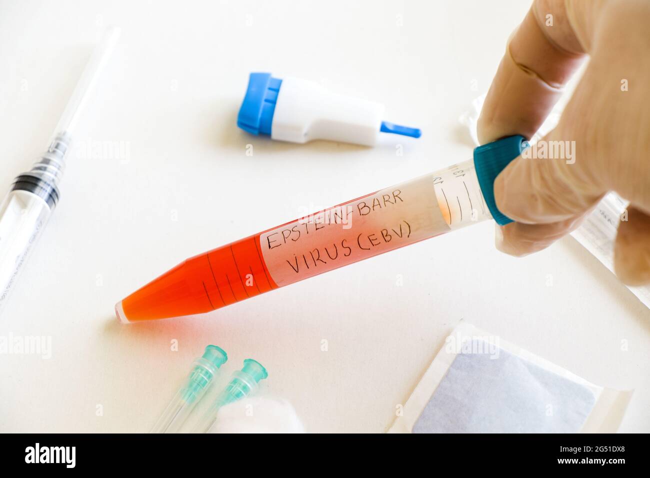 Closeup shot of a gloved hand holding an Epstein Barr virus blood test ...