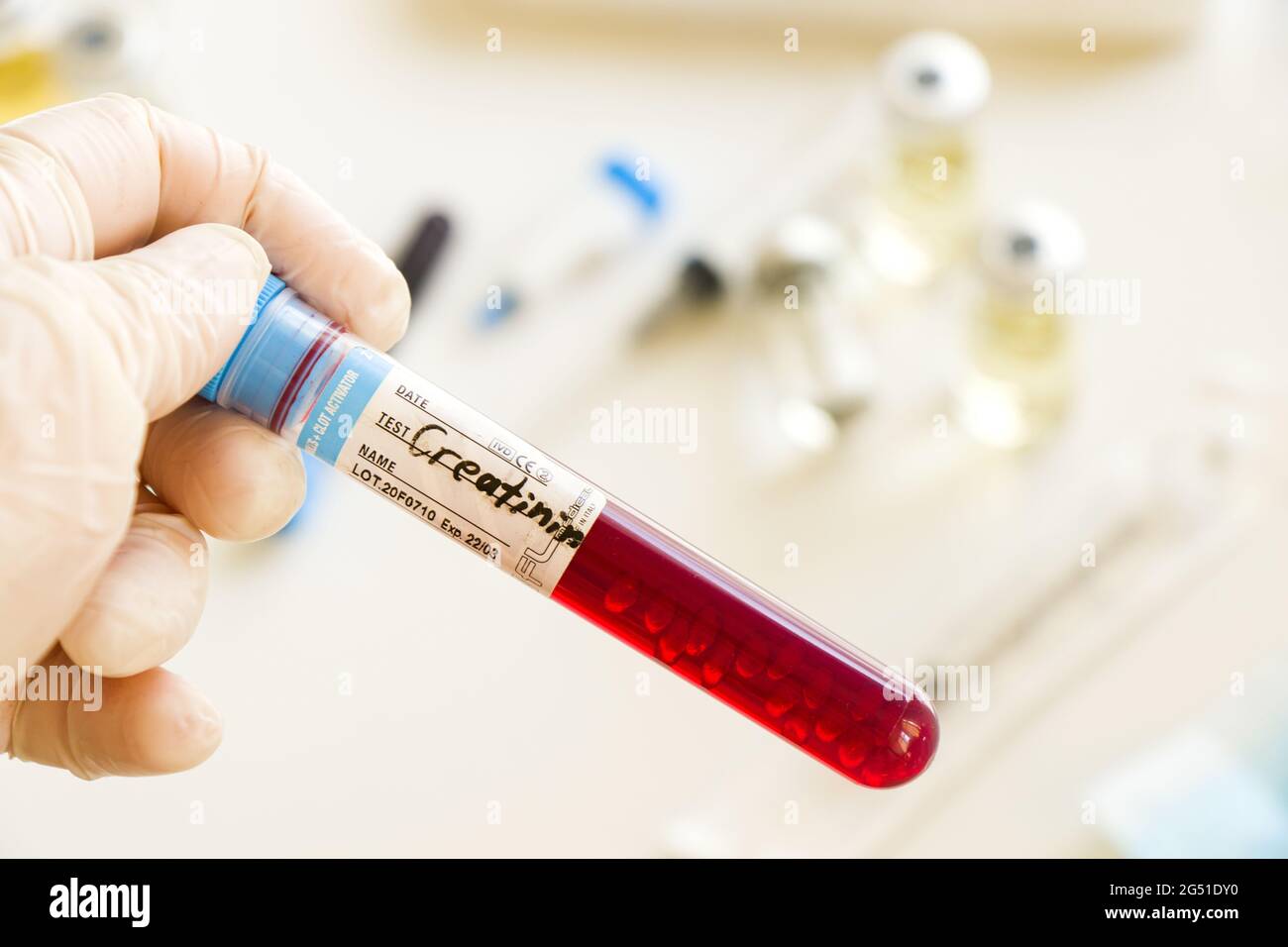 Creatinine blood test hi-res stock photography and images - Alamy