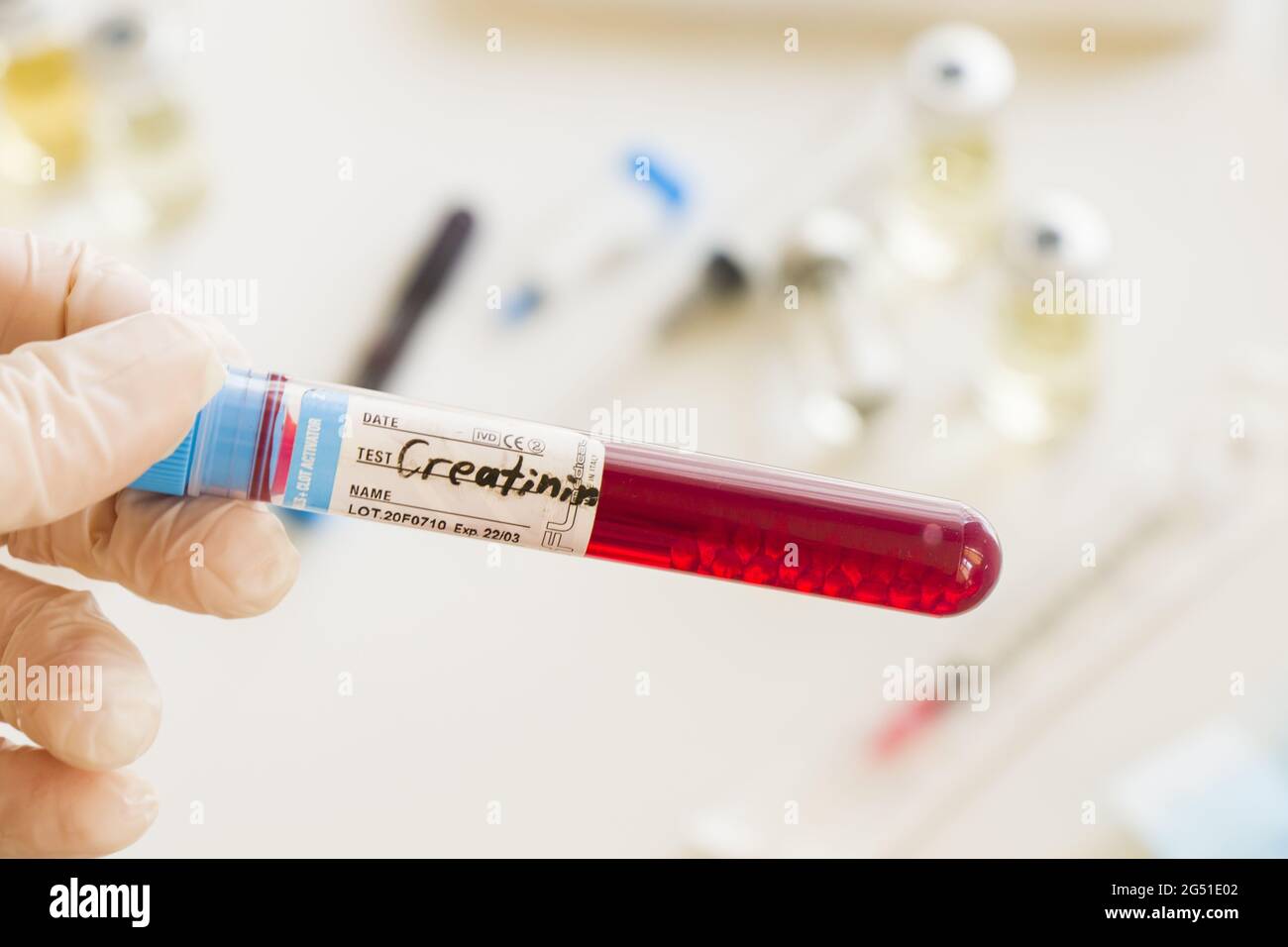 Creatinine blood test hi-res stock photography and images - Alamy
