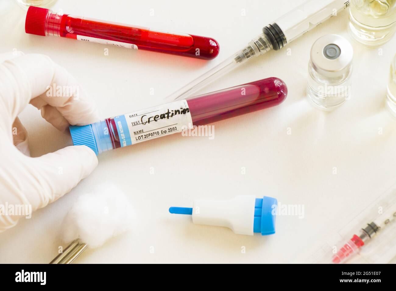 Creatinine blood test hi-res stock photography and images - Alamy
