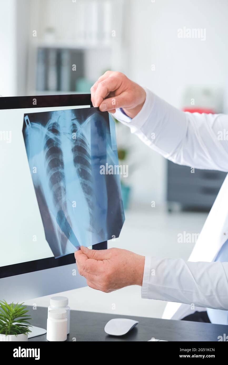 Pulmonologist with x-ray image of lungs in clinic Stock Photo - Alamy