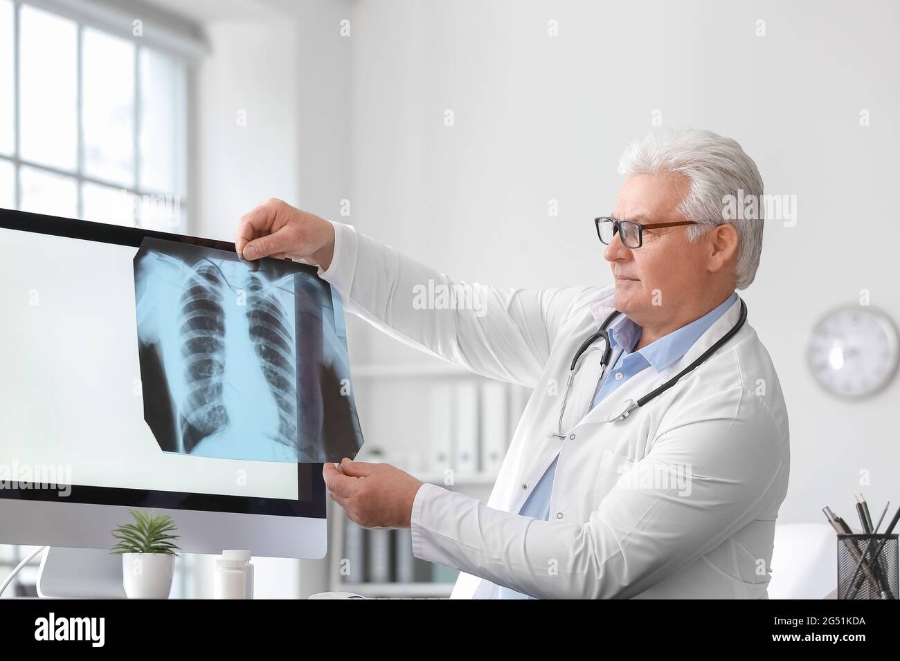 Pulmonologist with x-ray image of lungs in clinic Stock Photo - Alamy