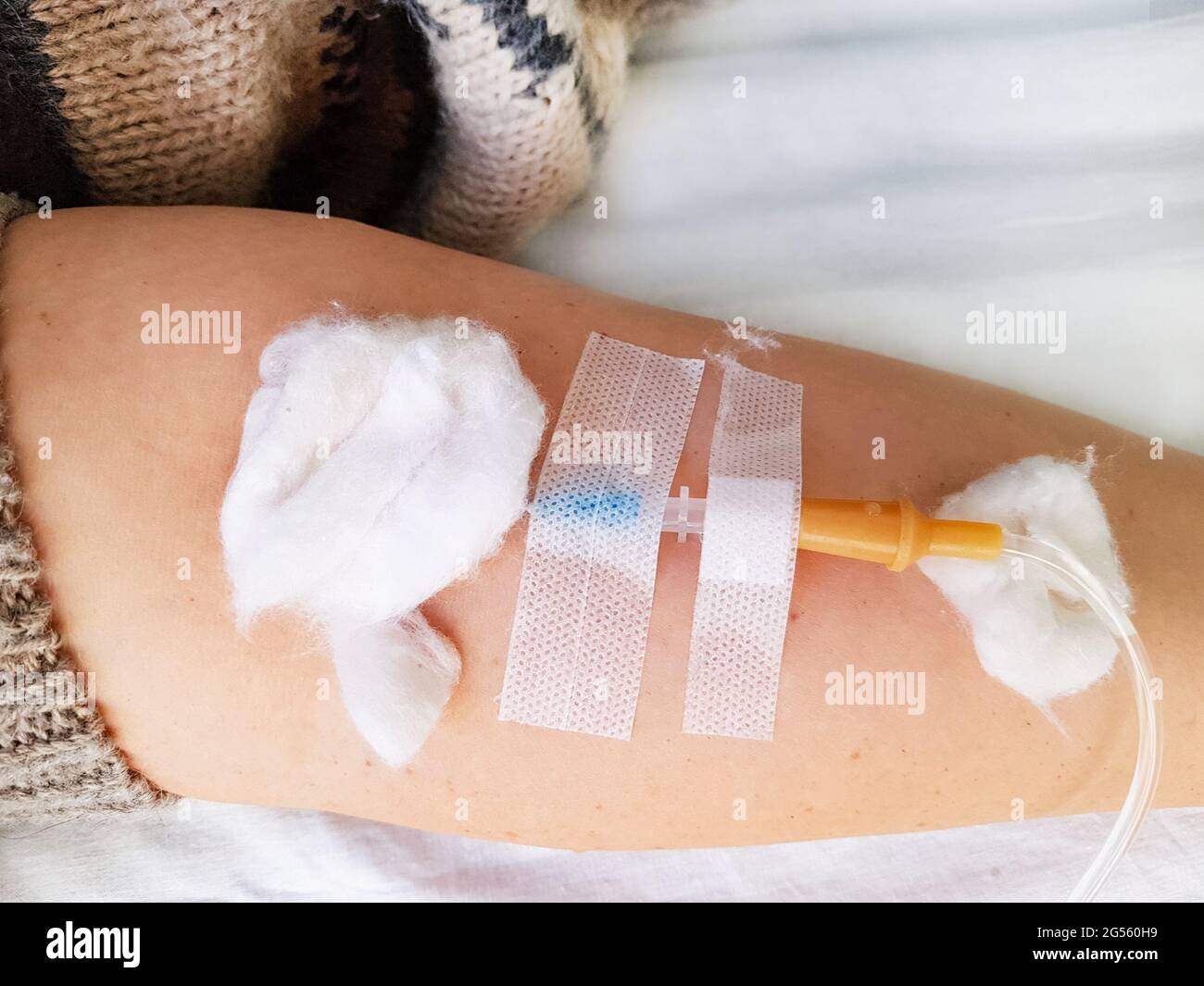 A woman is given an intravenous dropper in her hand. Closeup soft focus ...