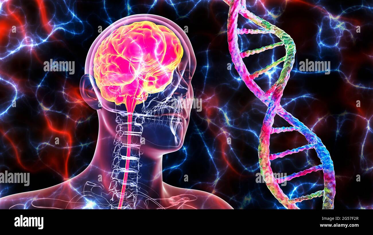 Genetic brain disorders, conceptual illustration Stock Photo - Alamy