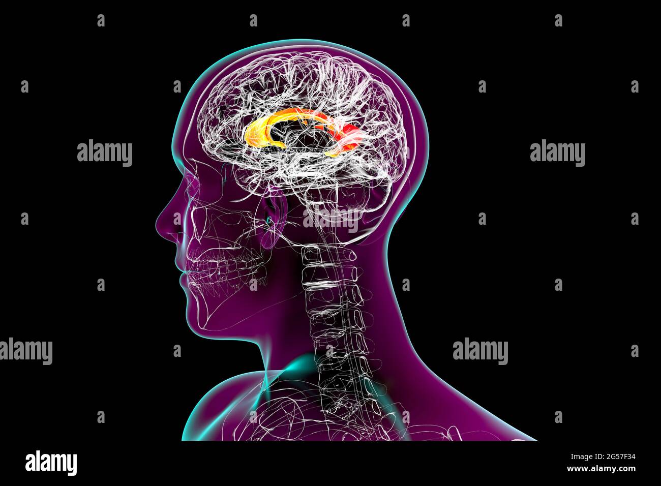 Human brain with highlighted corpus callosum, illustration Stock Photo ...