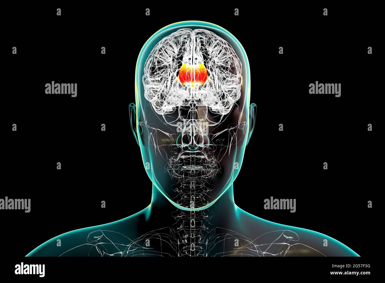 Human brain with highlighted corpus callosum, illustration Stock Photo ...