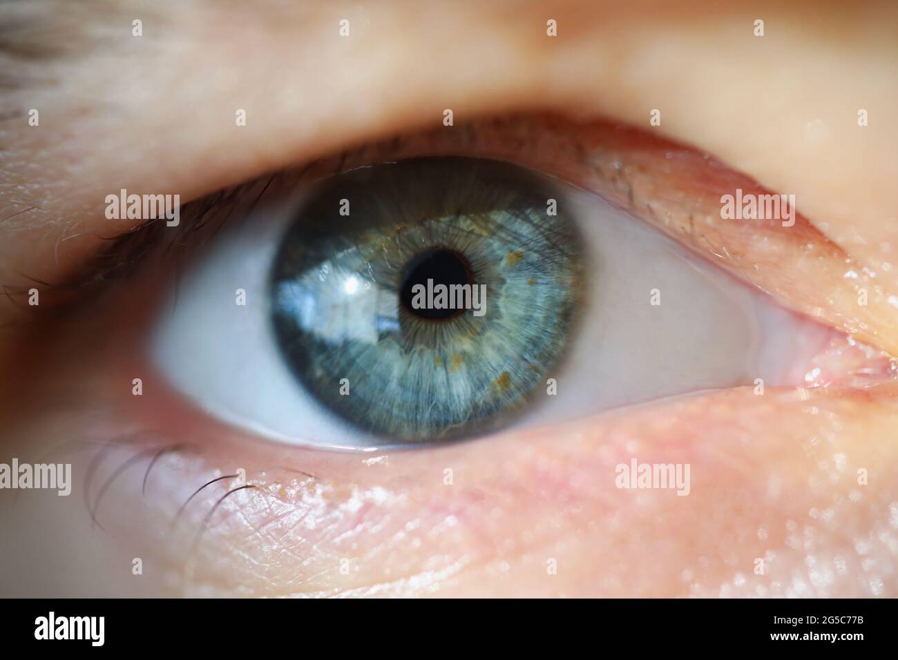 Drooping eyelid hi-res stock photography and images - Alamy