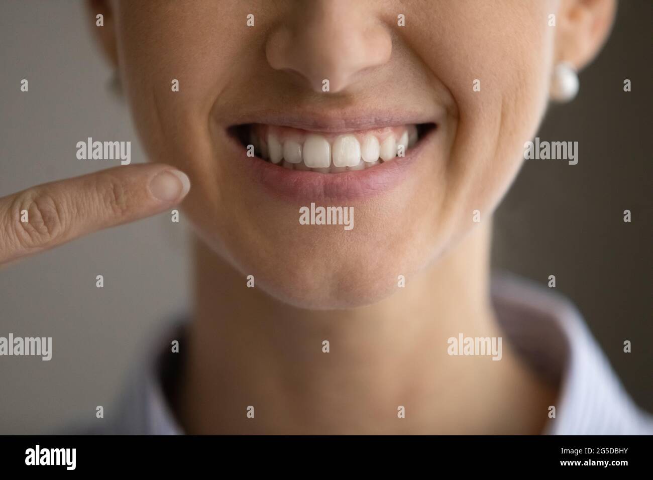 Young gingivitis hi-res stock photography and images - Alamy