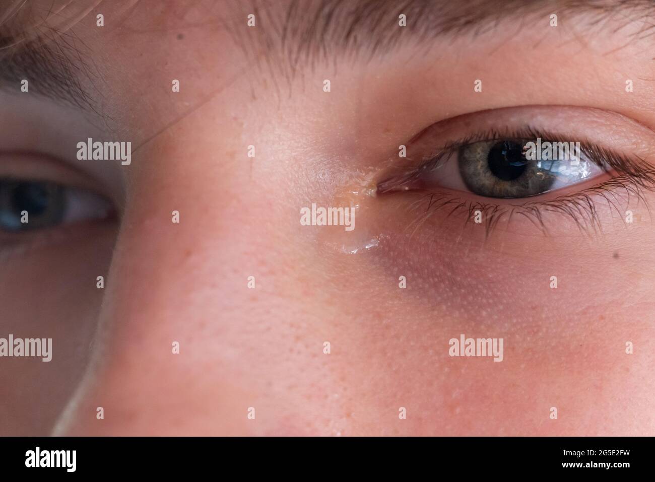 Man tear hi-res stock photography and images - Alamy