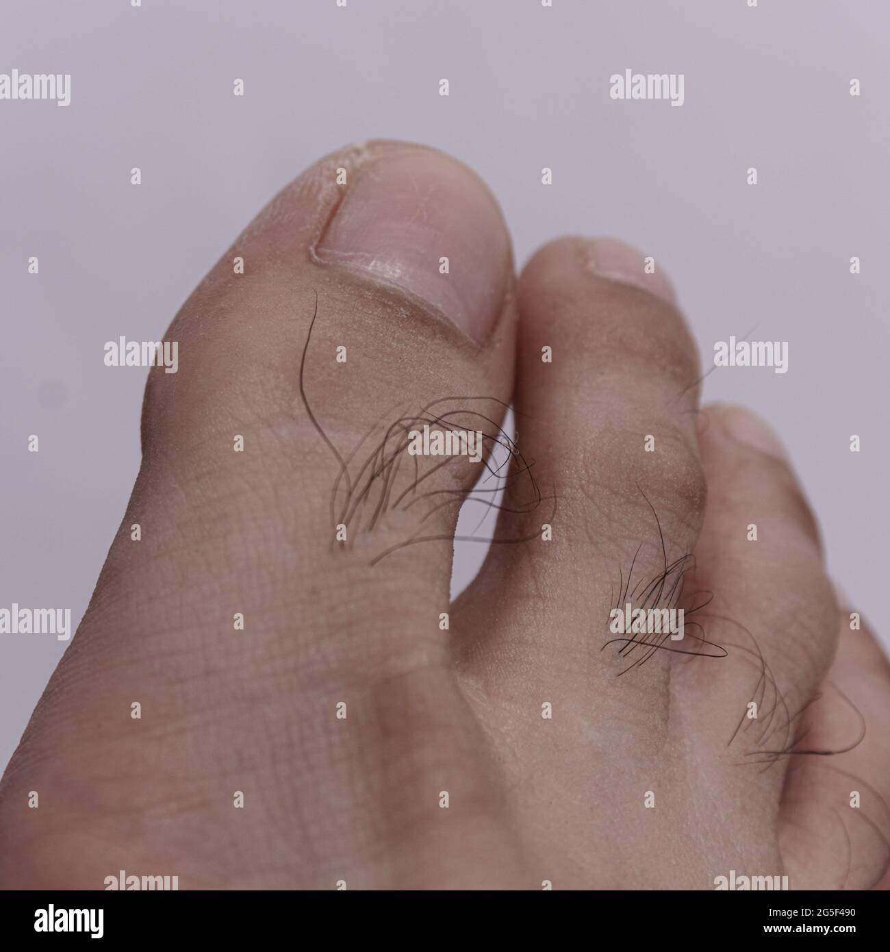 Adult woman ugly toe hair Stock Photo - Alamy