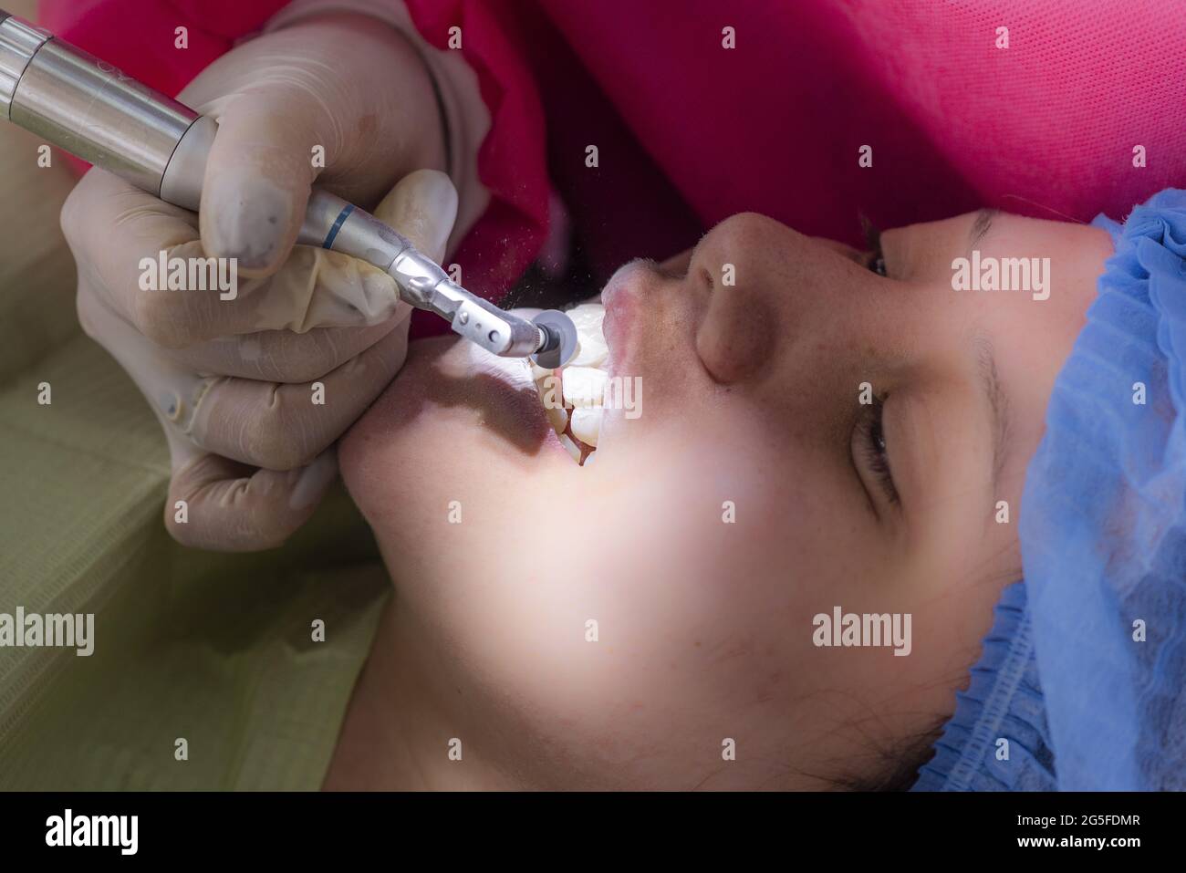 A closeup shot of a female patient being treated by the dentist Stock ...