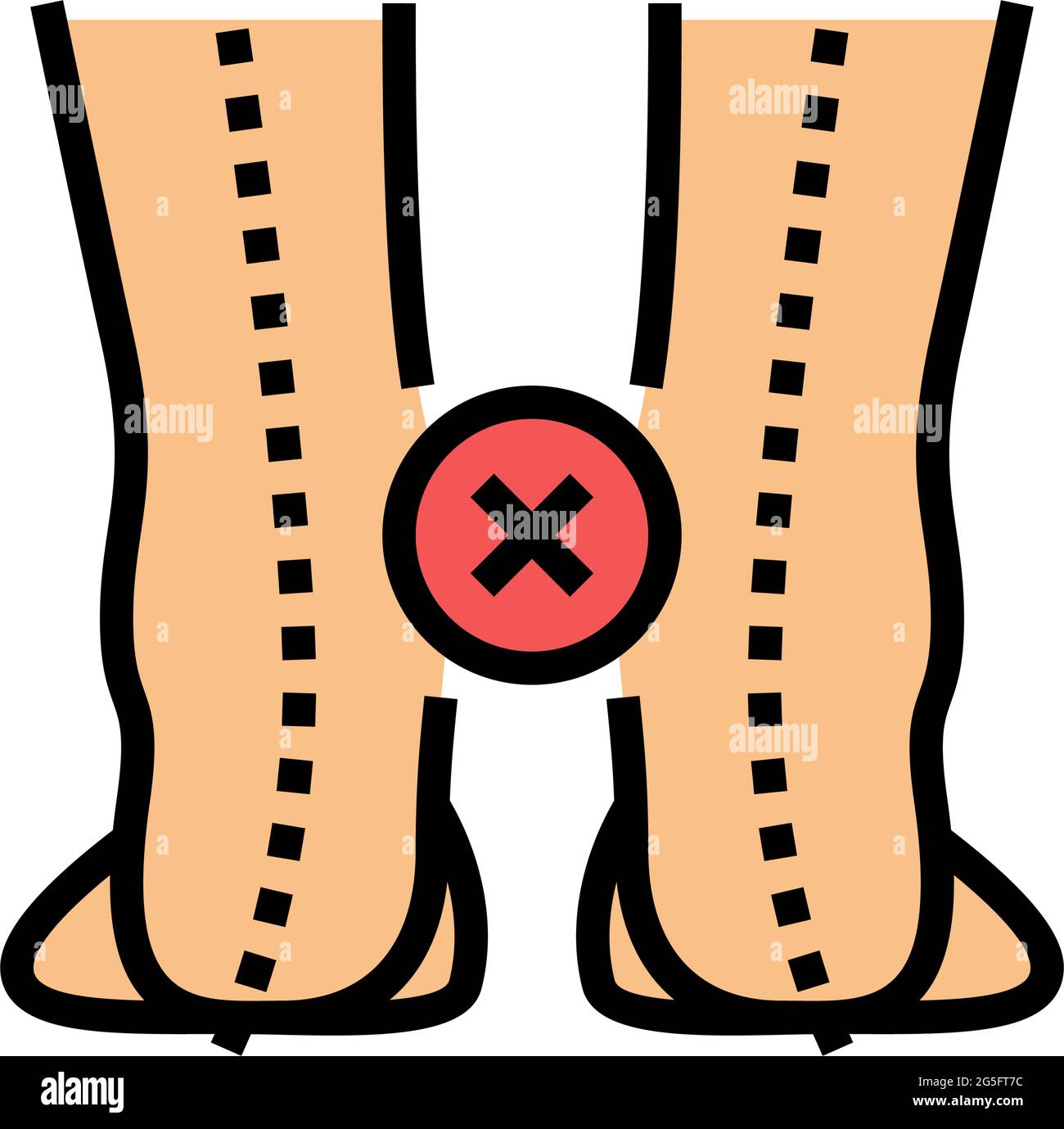 curvature of legs inward color icon vector illustration Stock Vector ...