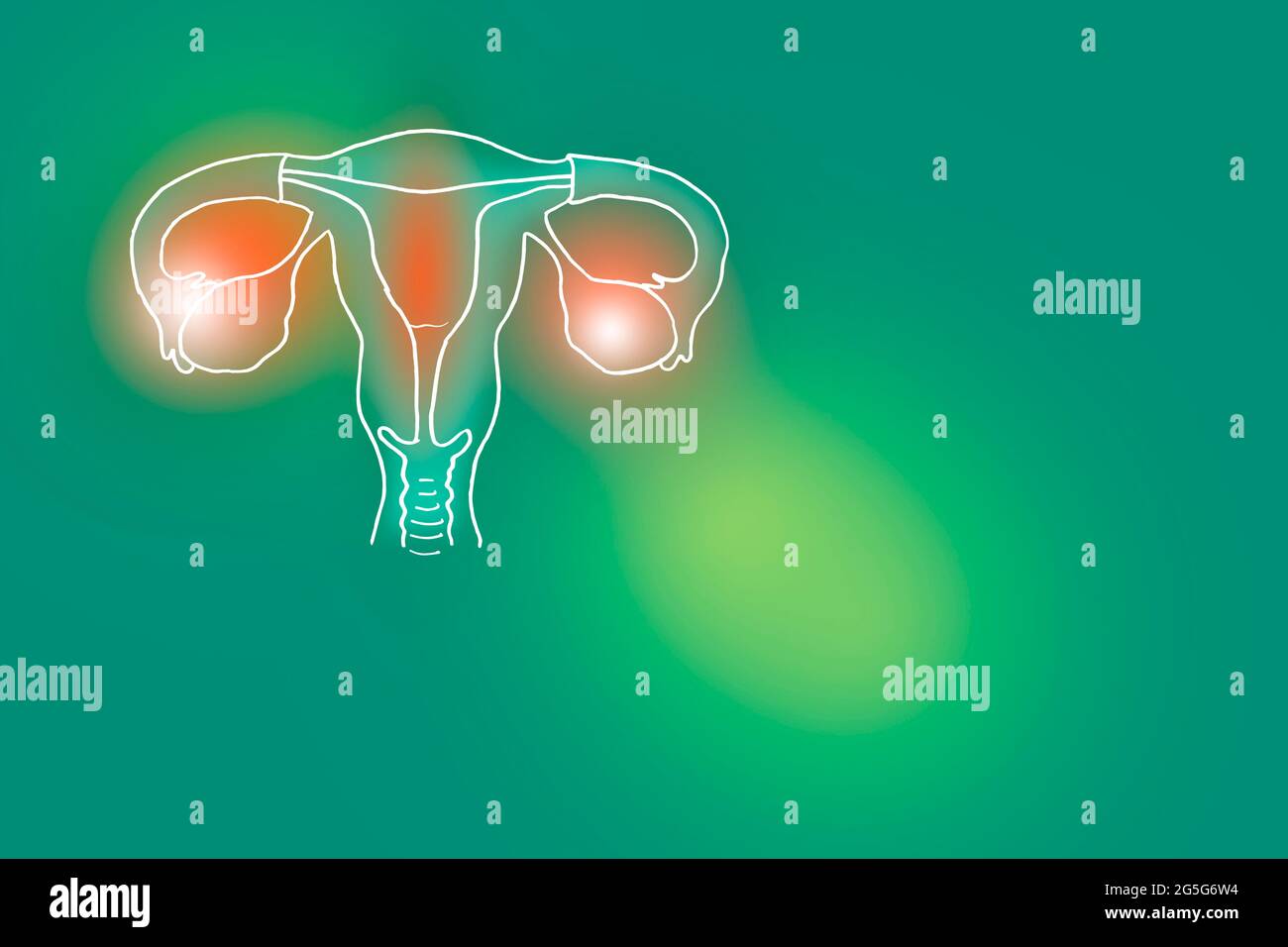 Uterine hi-res stock photography and images - Alamy