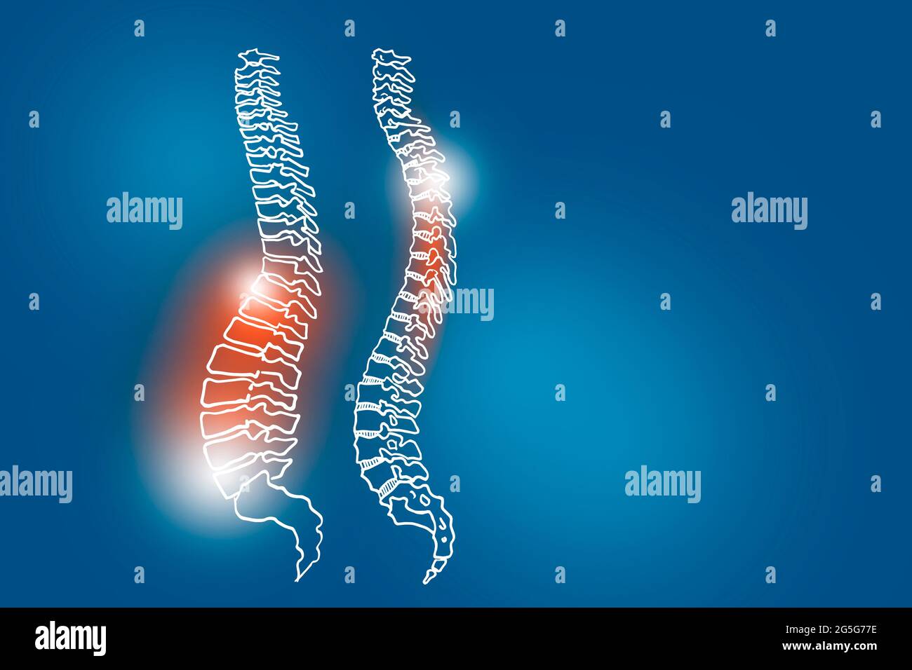 Handrawn illustration of human Spine on dark blue background. Medical ...