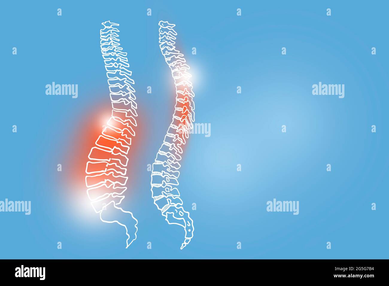 Handrawn illustration of human Spine on light blue background. Medical ...