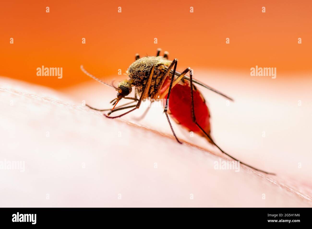 Zika Infected Mosquito Bite. Leishmaniasis, Encephalitis, Yellow Fever ...