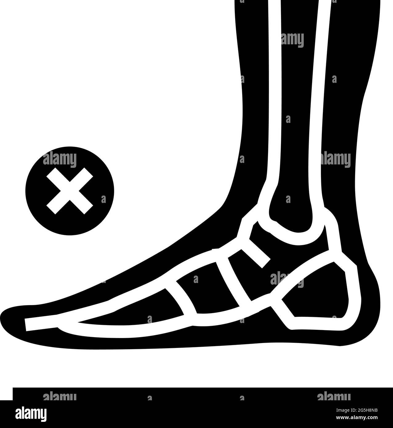 Bone postural deformity feet glyph hi-res stock photography and images ...