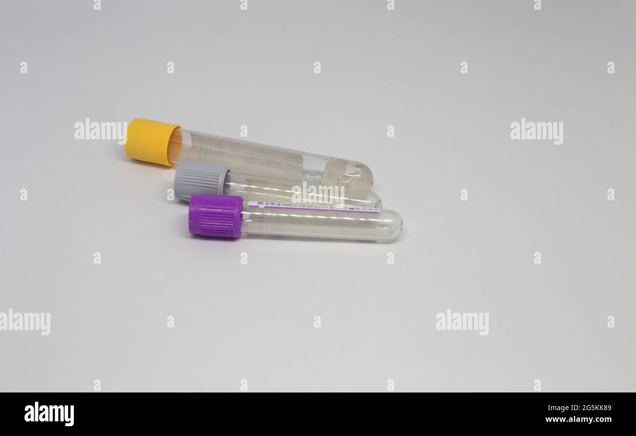 Top view of medical empty blood tubes isolated on white background ...